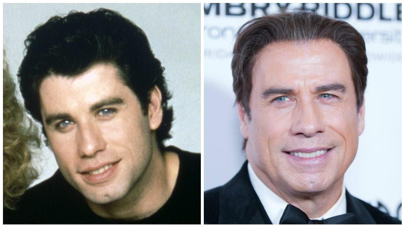 17 Celebrities Whose Faces Have Changed the Most Over Time