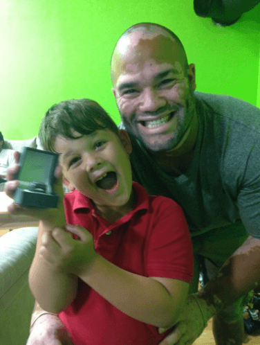 Celebrities You Didn't Know Have Vitiligo