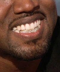 25+ Celebrities Who Dress Up Their Smiles With Tooth Gems