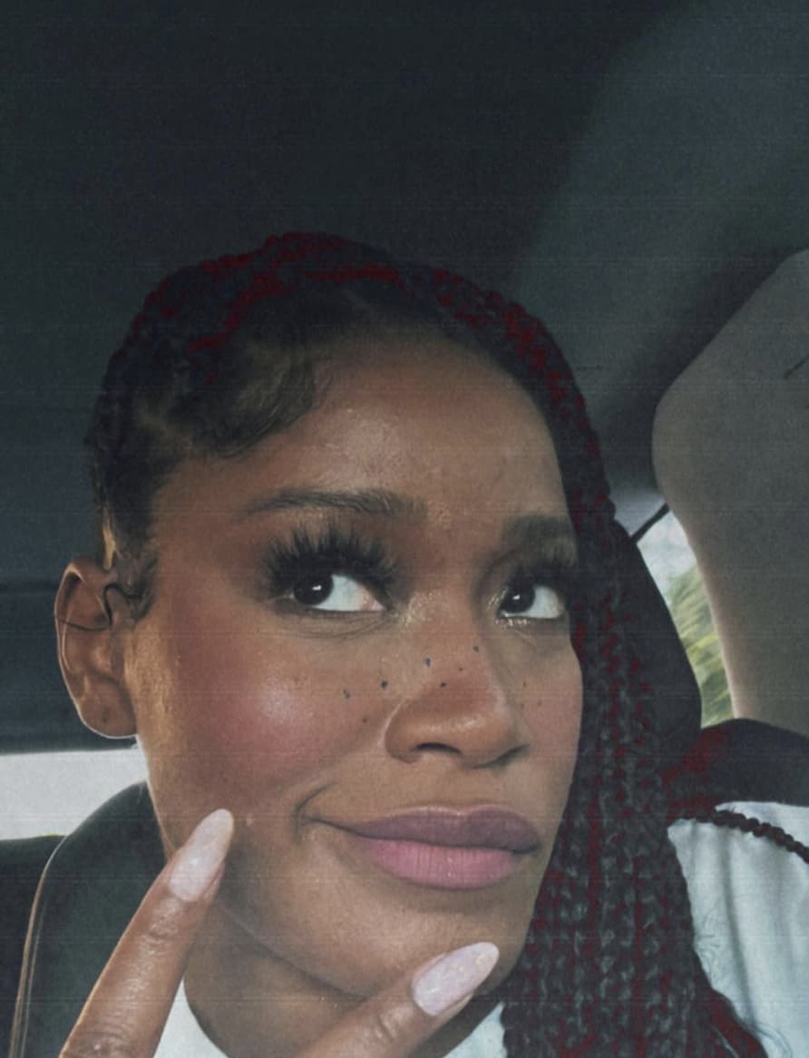 14 Celebrities With PCOS