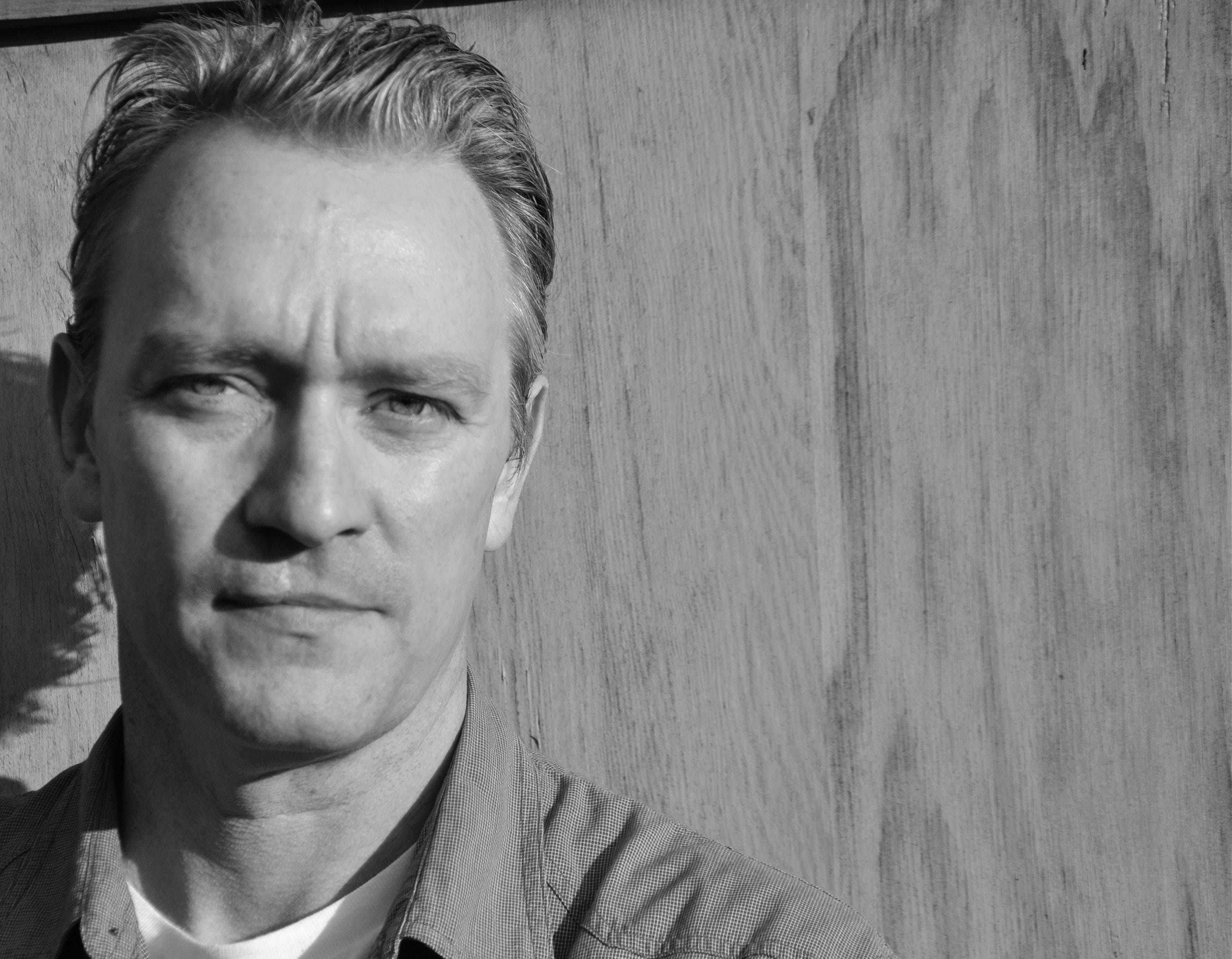 25+ Famous Celebrities Born With Cleft Lips