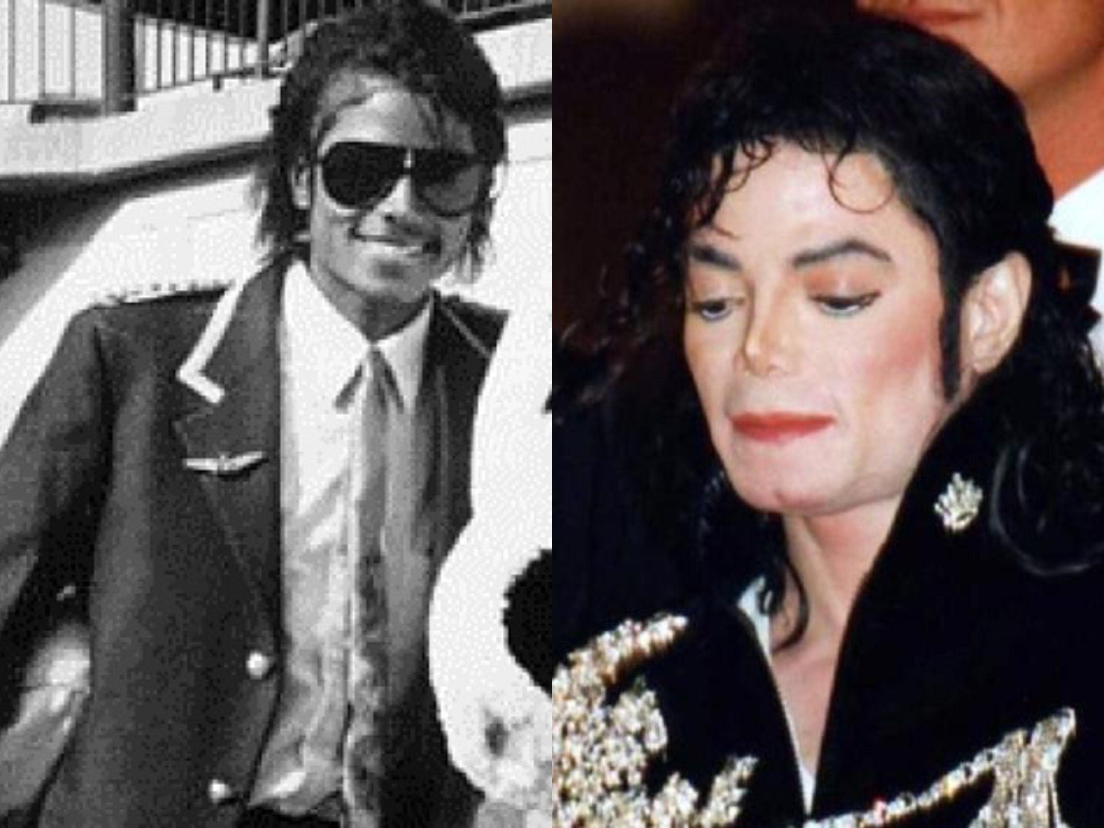 Celebrity Nose Jobs: Before and After