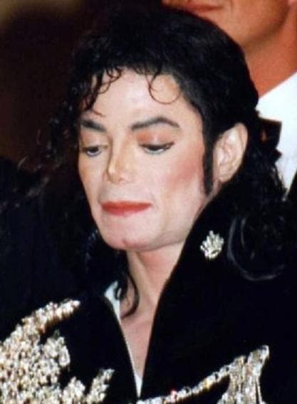 Celebrities You Didn't Know Have Vitiligo