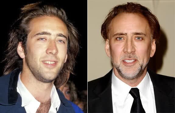 Celebrities with Fake Teeth | List of Famous People with Dentures and ...