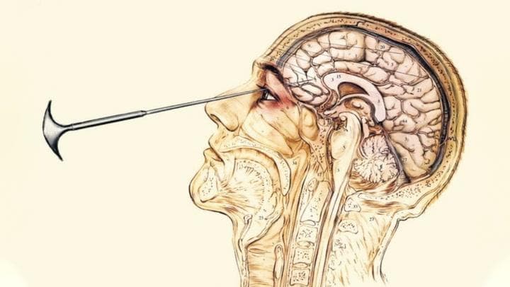 14 Facts About Walter Freeman II, The "Father of the Lobotomy"