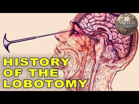 14 Facts About Walter Freeman II, The "Father of the Lobotomy"